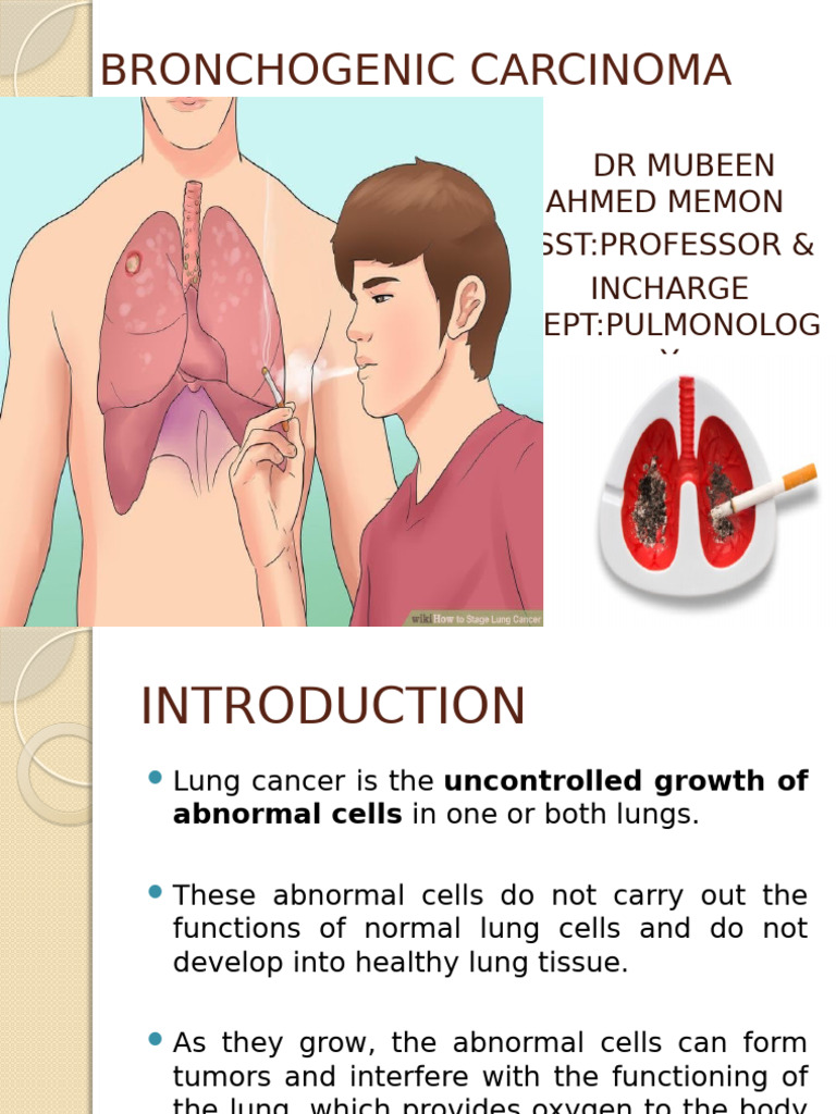 Lung Ca | PDF | Lung Cancer | Cancer