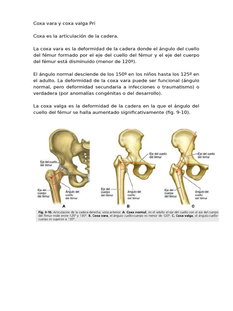 Coxa Vara y Coxa Valga | PDF