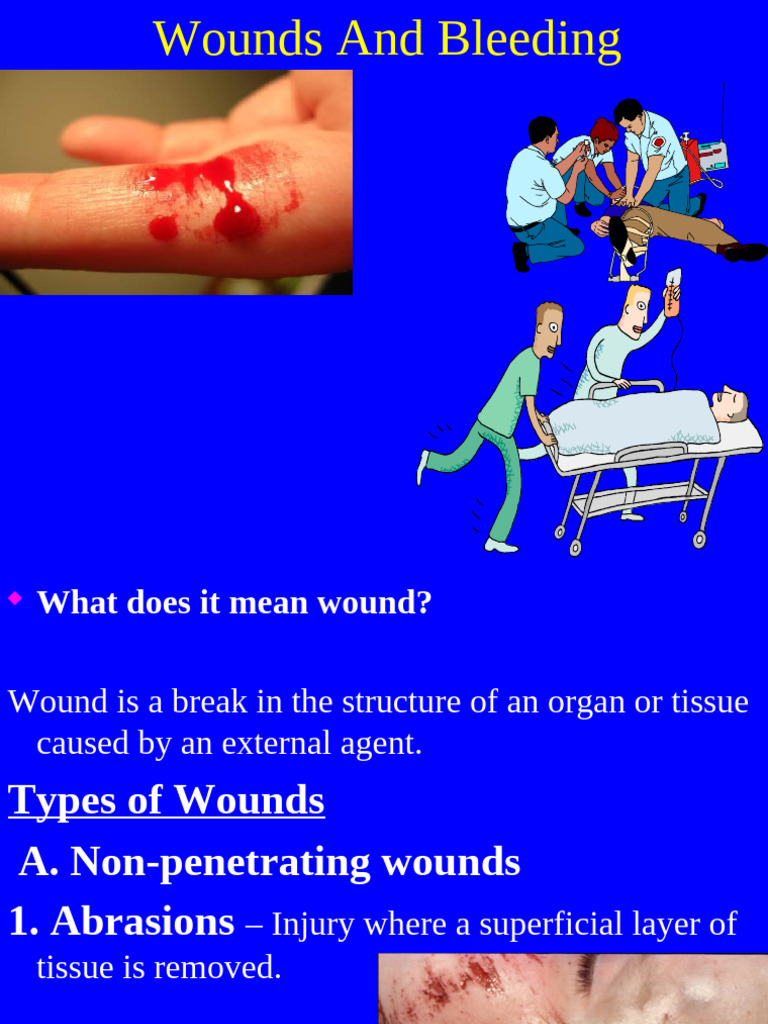 Wounds 4 201219201150 | PDF | Wound | Amputation