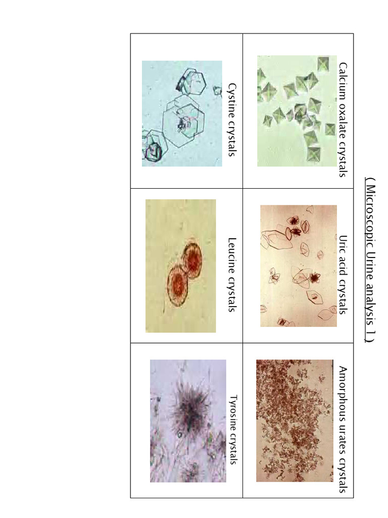 Microscopic Urine | PDF