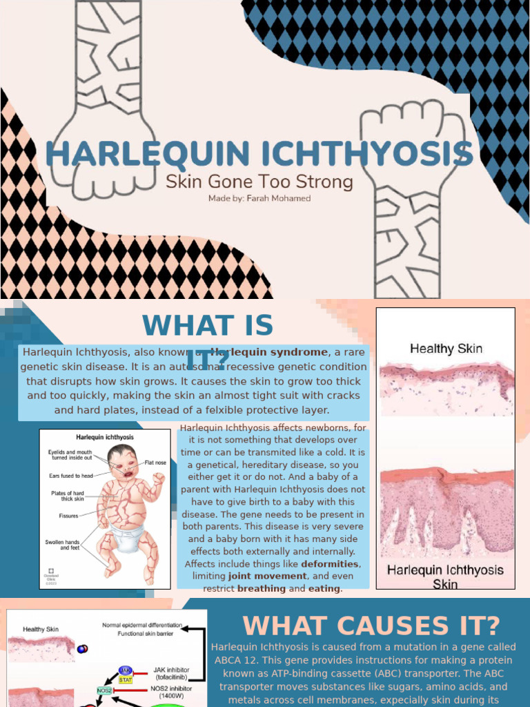 Harlequin Syndrome Skin Gone Too Strong | PDF | Causes Of Death ...