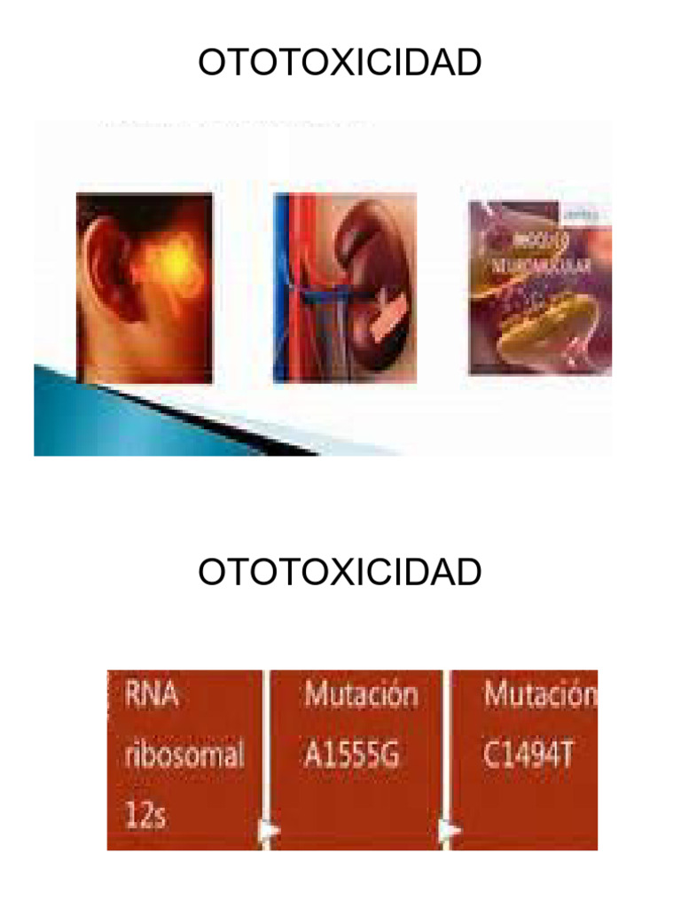 Ototoxicidad: Causas y Efectos | PDF | Especialidades Medicas | Drogas