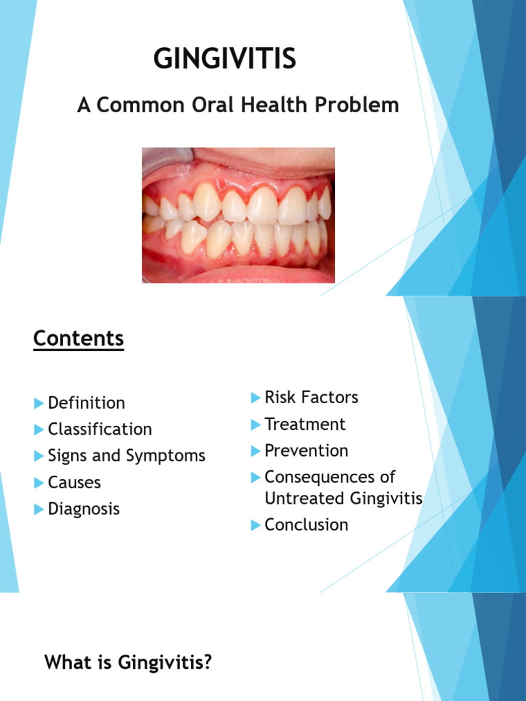 Gingivitis | PDF | Periodontology | Oral Hygiene