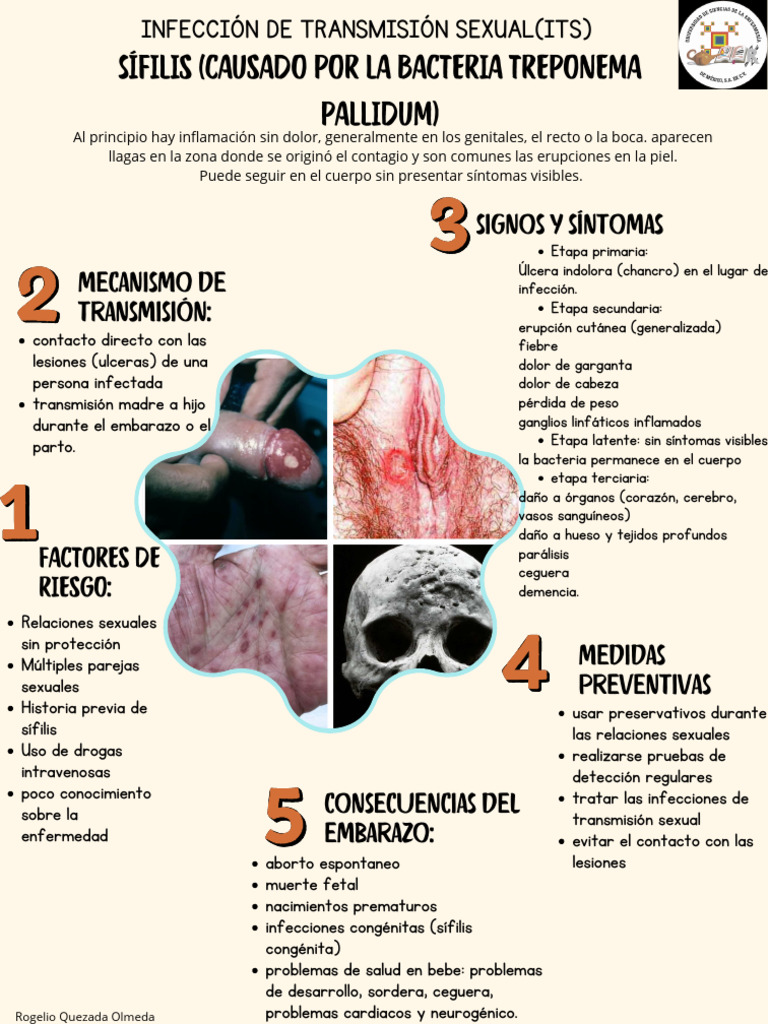 sÍFILIS (CAUSADO POR LA BACTERIA TREPONEMA PALLIDUM | PDF | Infección ...