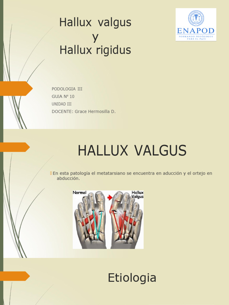 GUÌA 10, HALLUX VALGUS Y HALLUX RIGIDUS, UNIDAD III, Podologia III (D-V ...