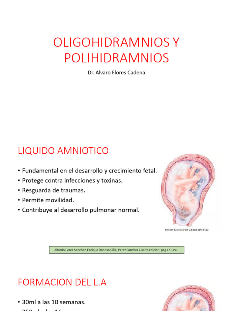 Oligohidramnios y Polihidramnios: Guía Clínica | PDF | Medicina | Salud ...