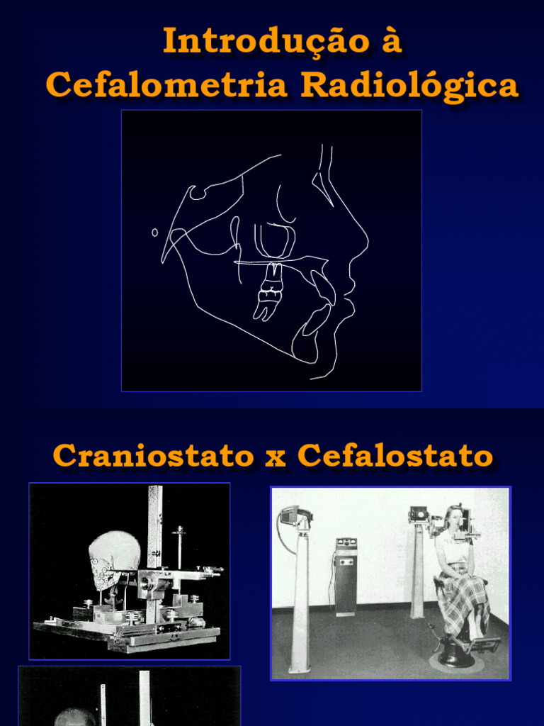 Introdução à Cefalometria Radiológica | PDF