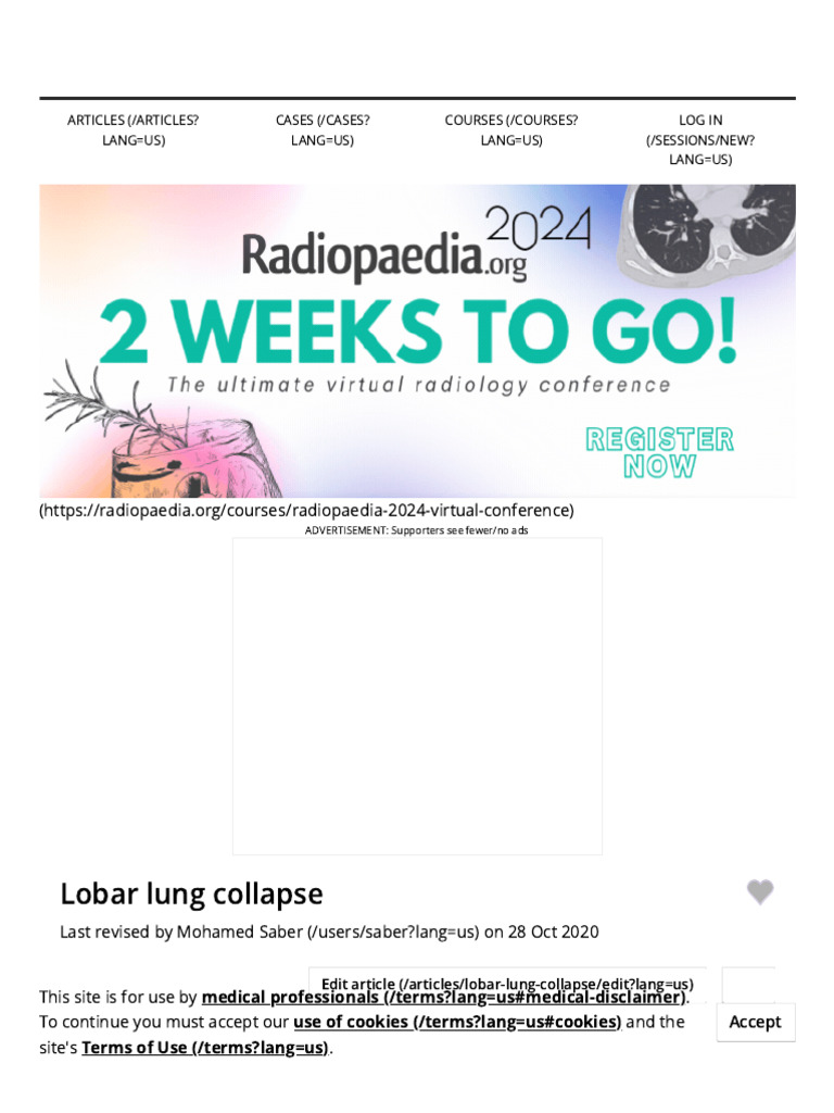 Lobar Lung Collapse - Radiology Reference Article | PDF | Diseases And ...