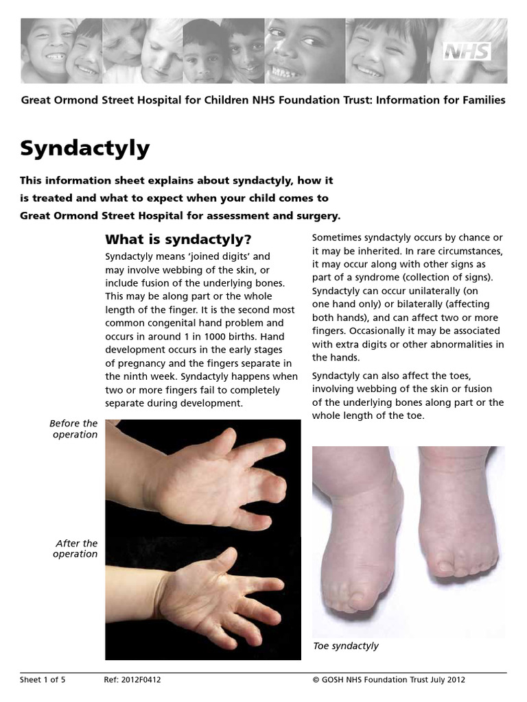 Syndactyly F0412 A4 BW FINAL Jul12 | PDF | Scar | Surgery