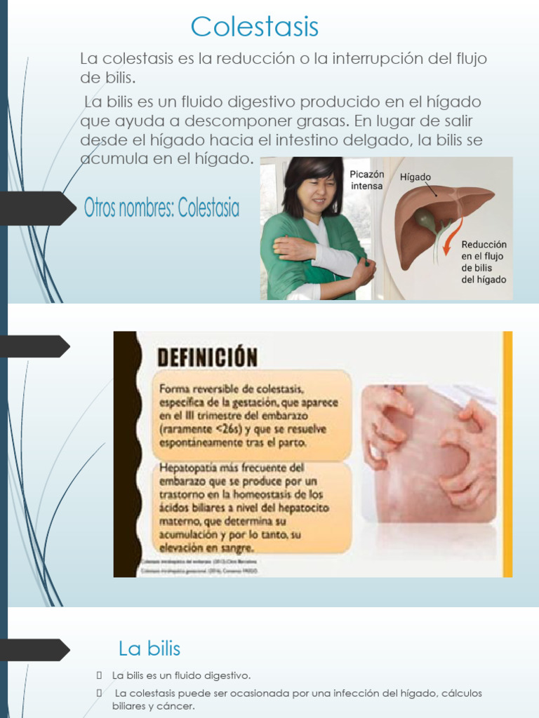 Colestasis Intrahepática en Embarazo | PDF | Bilis | El embarazo