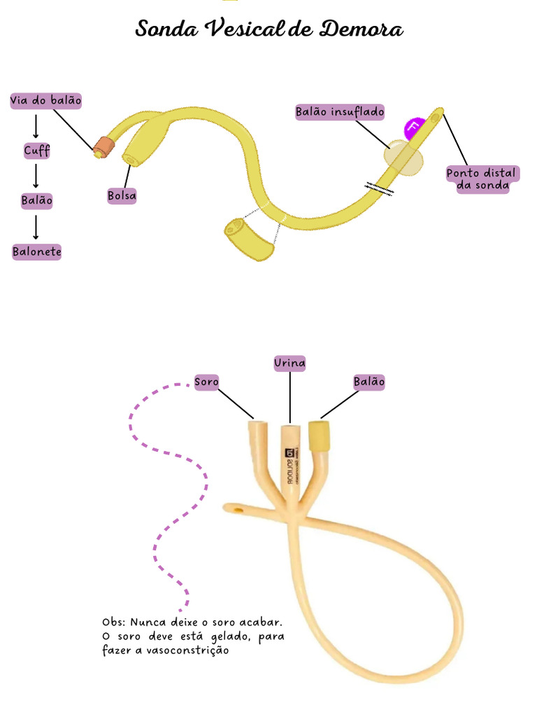 Sonda Vesical de Demora | PDF