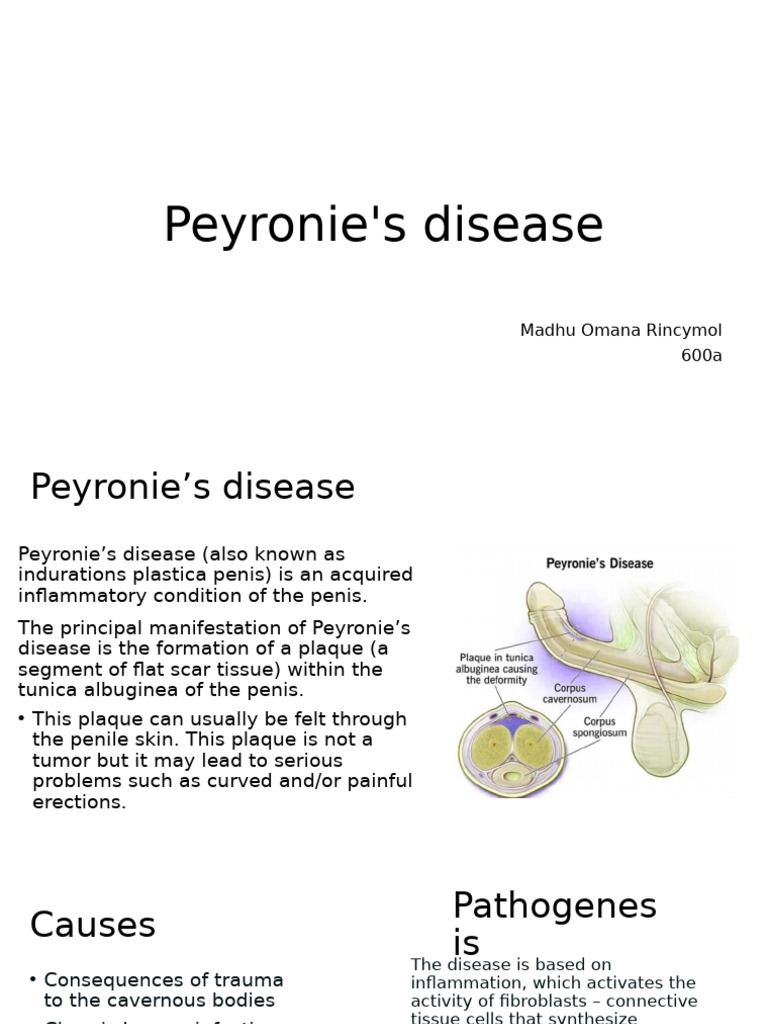 Understanding Peyronie's Disease Symptoms | PDF | Clinical Medicine ...
