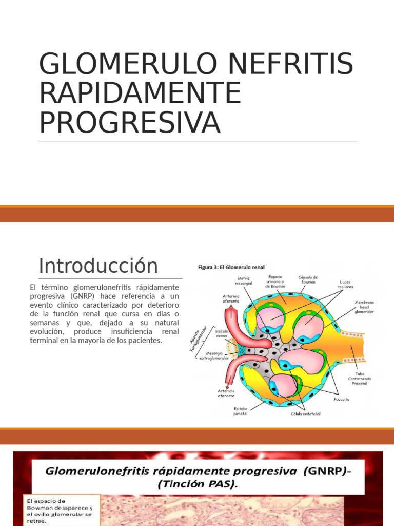 Glomerulonefritis Rápidamente Progresiva | PDF | Medicina Interna | Especialidades Medicas