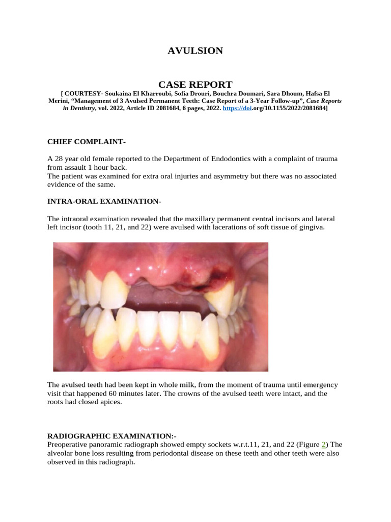 AVULSION With Mcqs | PDF | Human Tooth | Medical Specialties