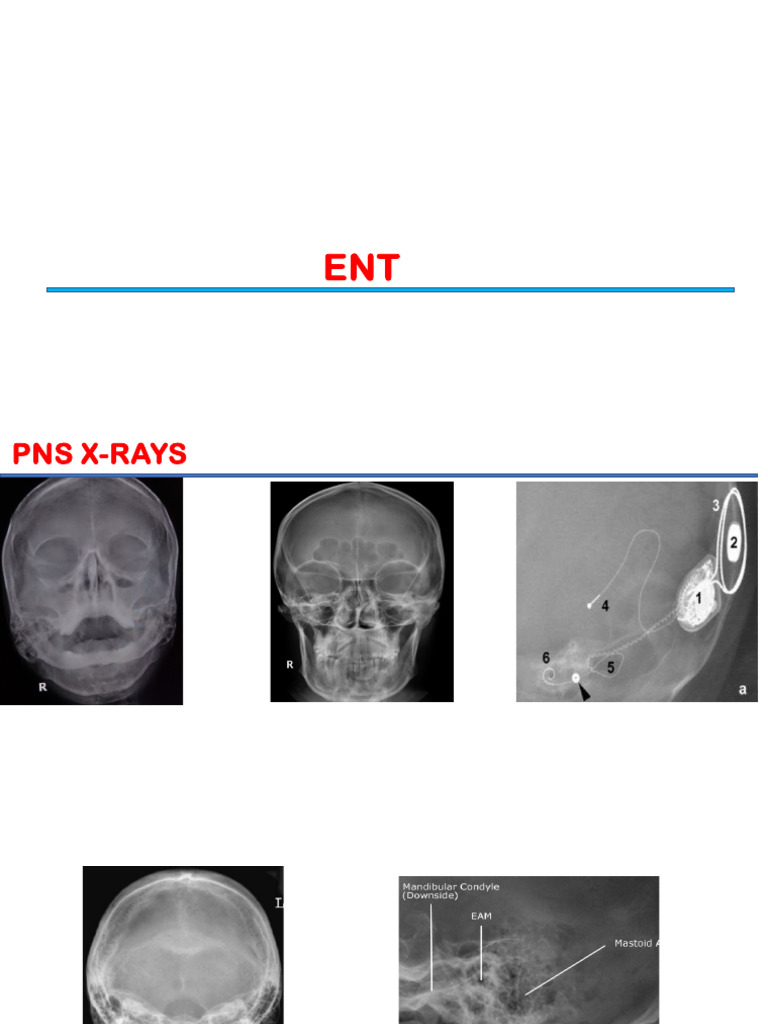 Comprehensive Guide to ENT Pathologies | PDF | Human Nose | Larynx