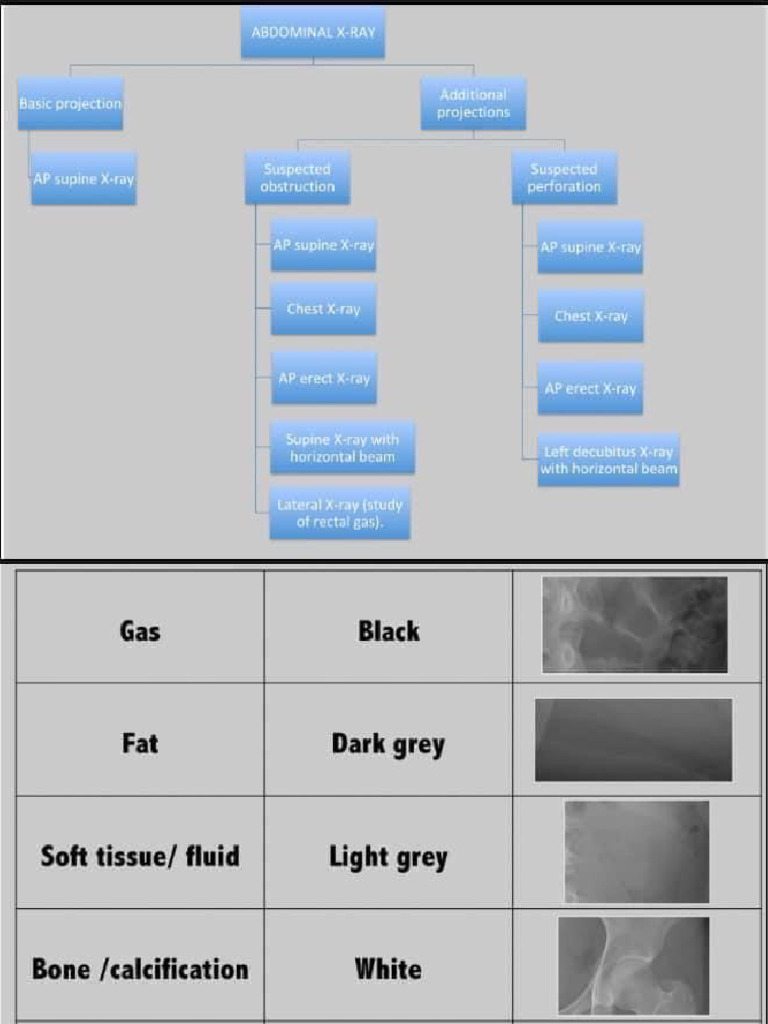 Abdominal X-Ray Key Point | PDF