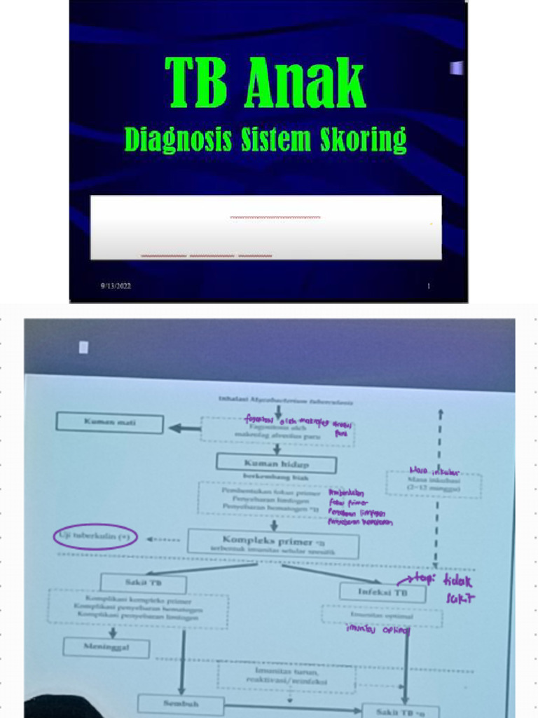 LBM1 - TB Anak - 241005 - 054756 | PDF