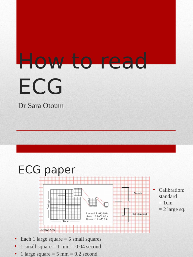 ECG Reading Guide: Key Components Explained | PDF | Electrocardiography ...