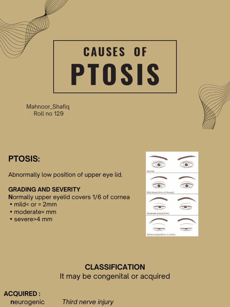 Causes of Ptosis Mahnoor Shafiq - 20241101 - 153556 - 0000 | PDF | Ophthalmology | Medical ...