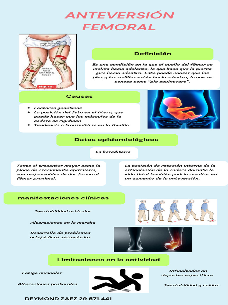 Infografía Anteversión Femoral | PDF