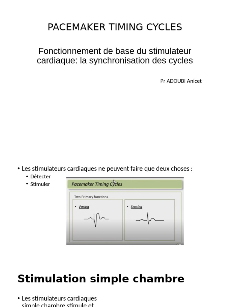 Pacemaker Timing Cycle | PDF | Stimulateur cardiaque | Cœur