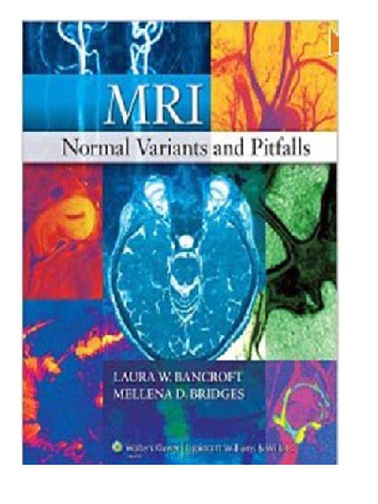 MRI Normal Variants and Pitfalls | PDF
