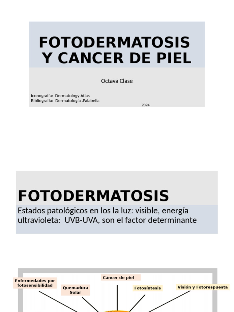 VIII Clase Fotodermatosis y Tumores | PDF | Ultravioleta | Melanoma