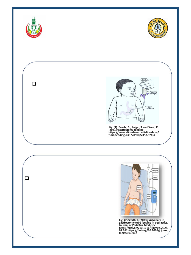 Gastrostomy_feeding-1[1] | PDF | Gastroenterology | Medical Procedures