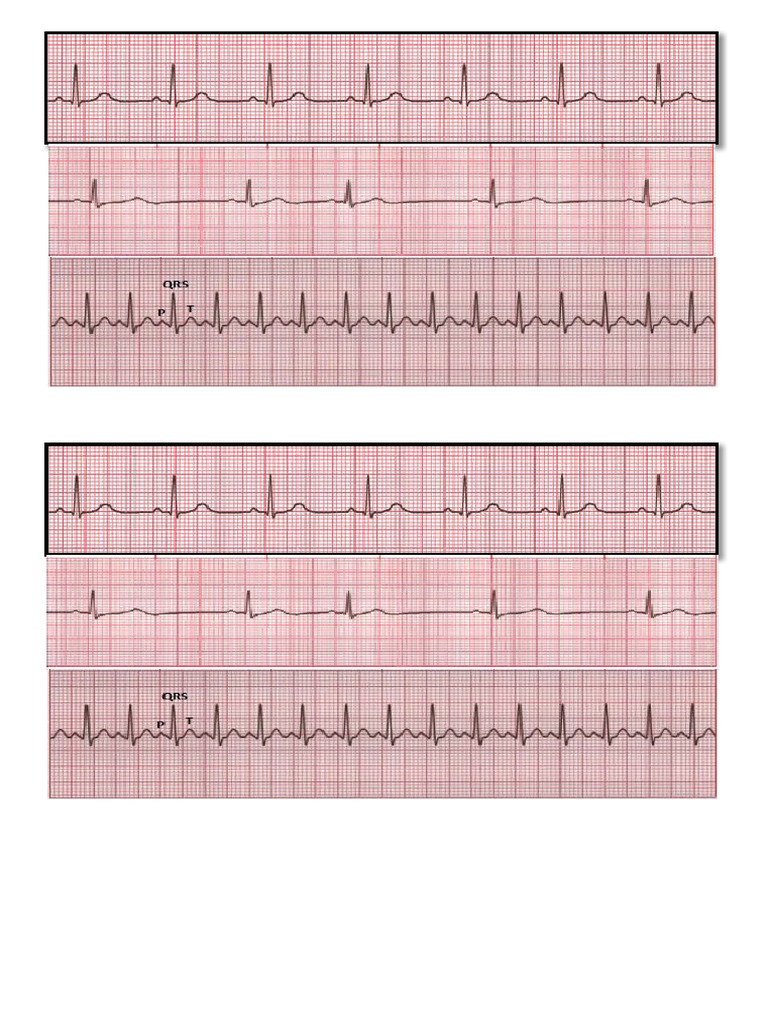 Gambar Ekg Buat Latihan | PDF