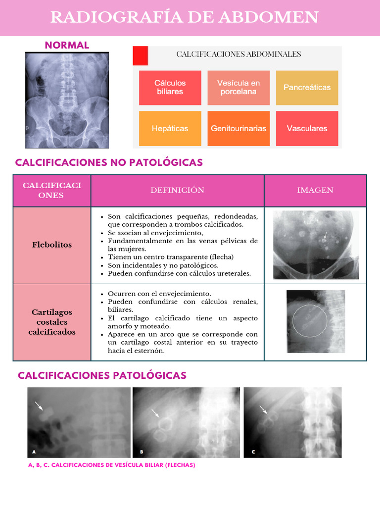 Radiografía de Abdomen | PDF