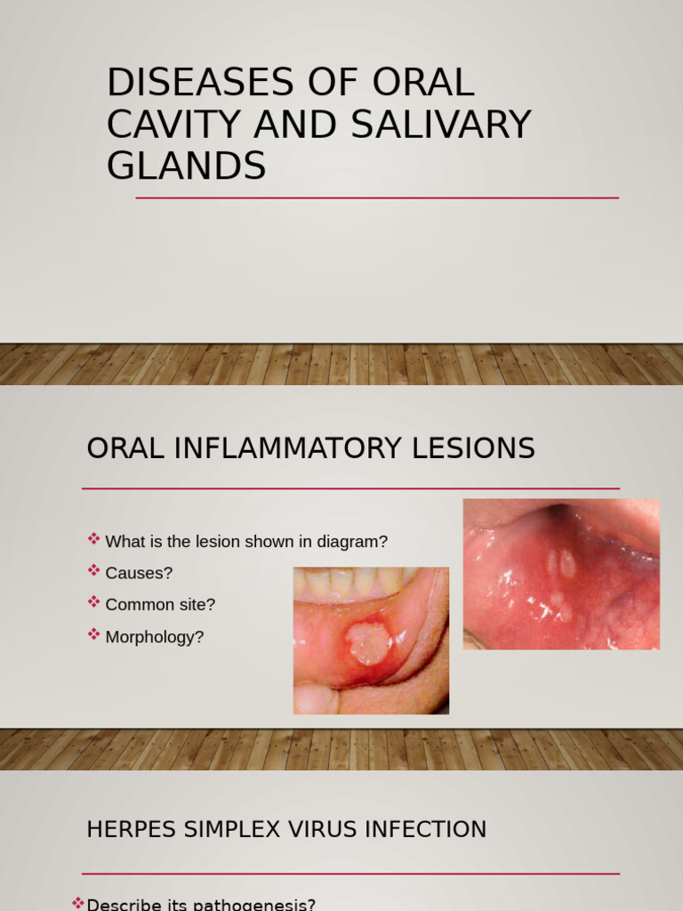 Diseases Of Oral Cavity And Salivary Gland Pdf