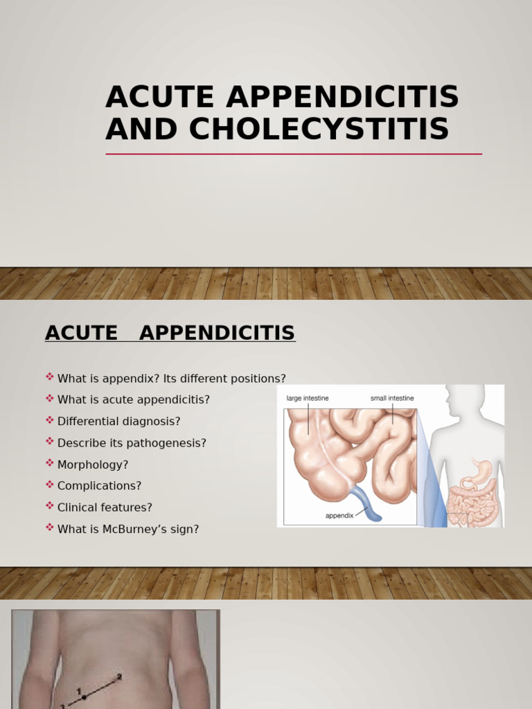 Acute Appendicitis and Cholecystitis | PDF