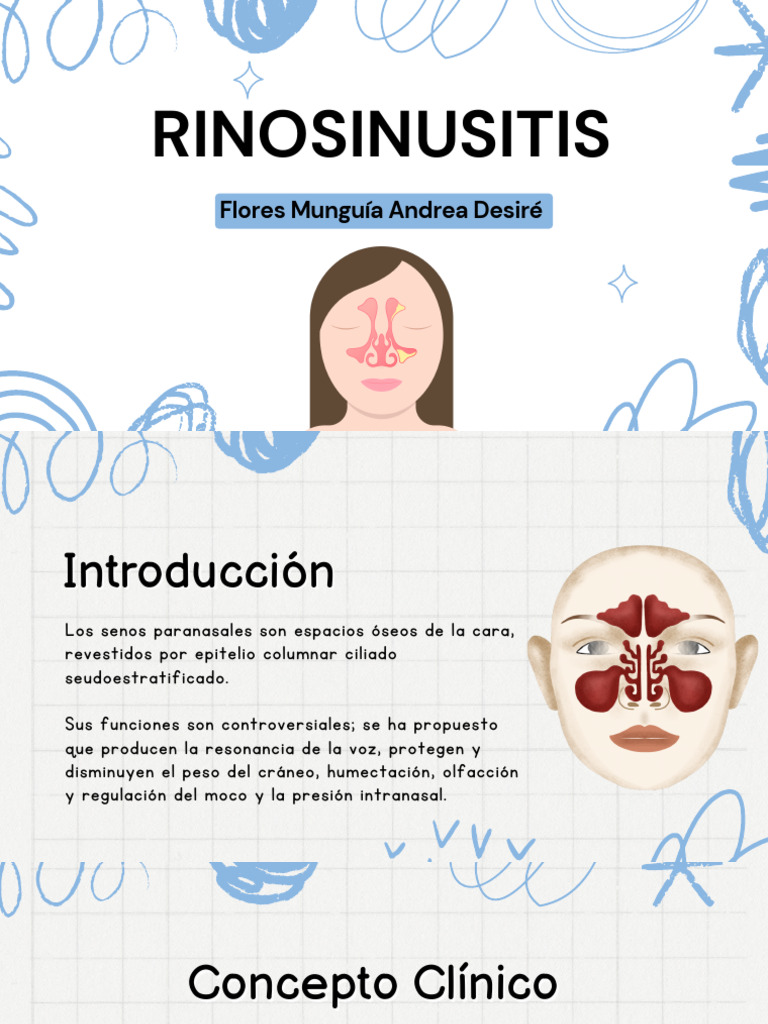 Guía Completa sobre Rinosinusitis | PDF | Otorrinolaringología ...
