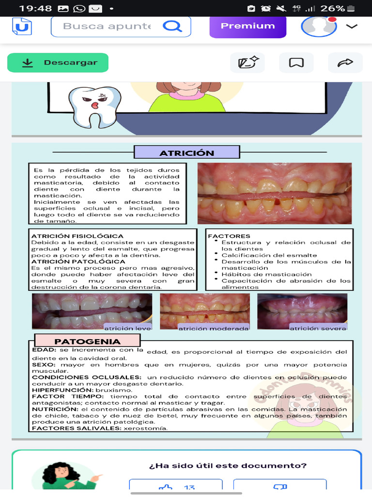 Erosión y Atricion | PDF