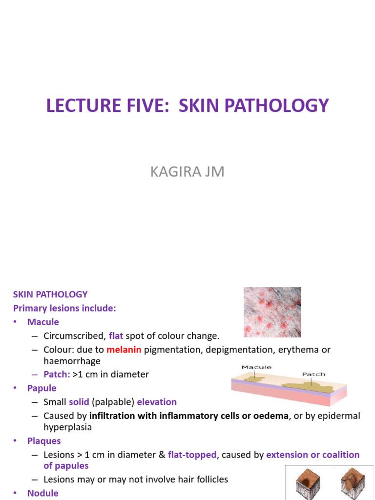 Lecture Five - Skin Pathology 2022 | PDF | Dermatitis | Skin