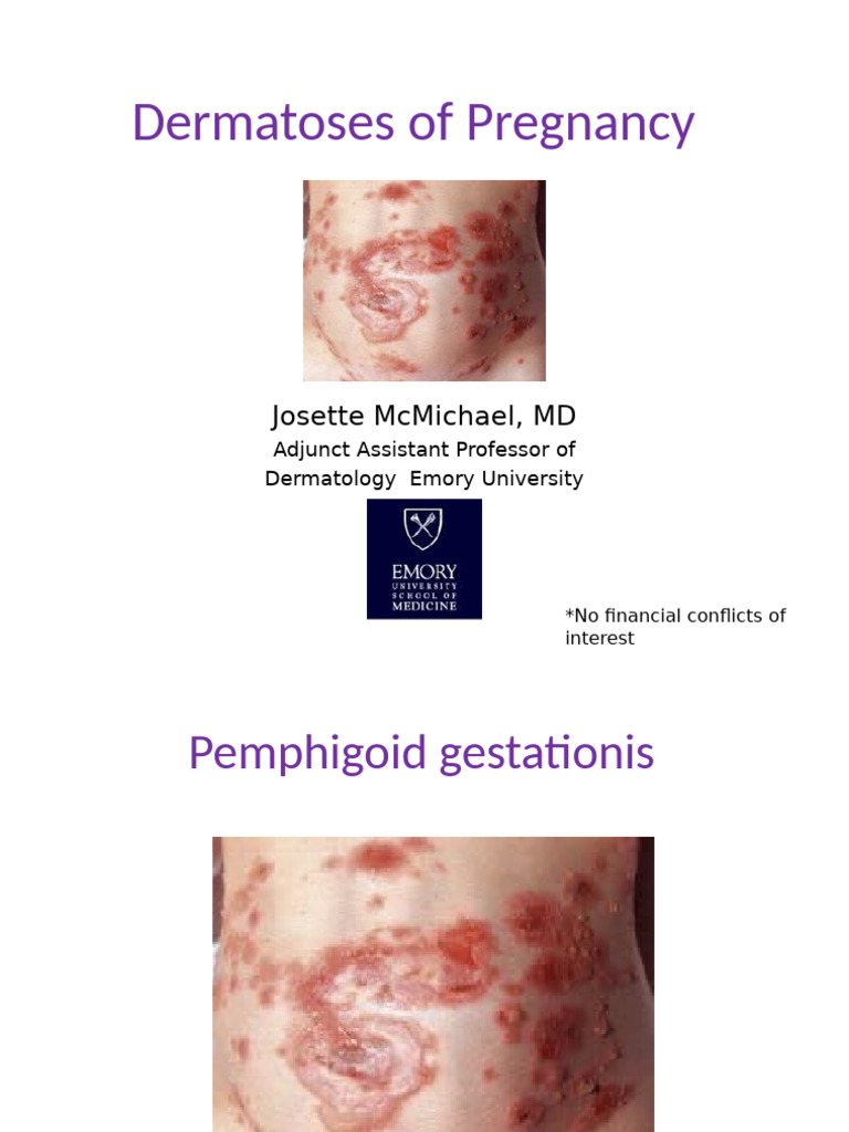 Pregnancy Dermatoses: Types & Treatments | PDF | Medical Specialties ...