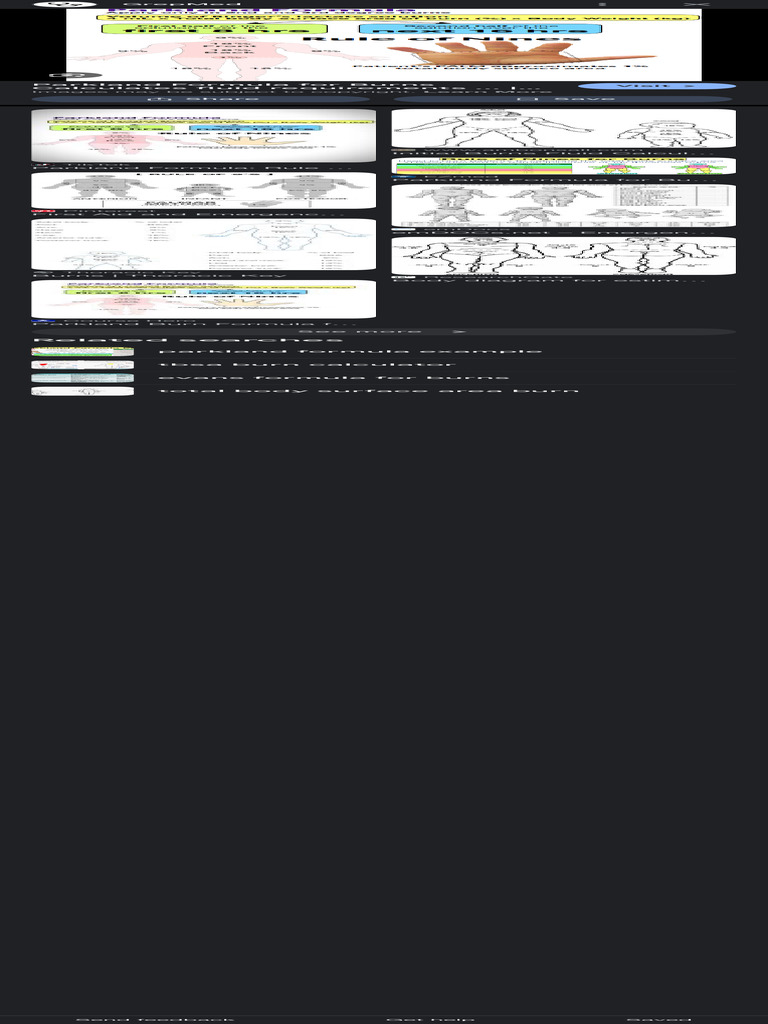 Volume Ringer's Lactate Burns - Google Search | PDF