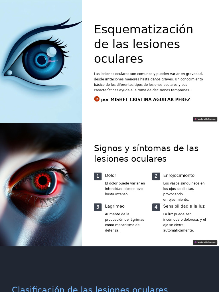 Esquematizacion de Las Lesiones Oculares | PDF