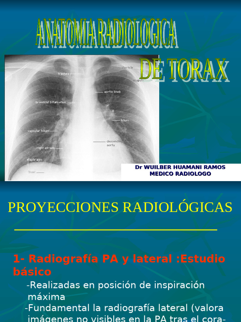 Anatomia RX Torax | PDF | Pulmón | Aorta