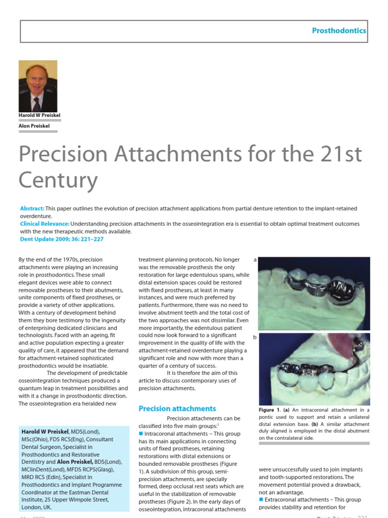 Precision Attachments For The 21st Century | PDF | Dental Implant ...