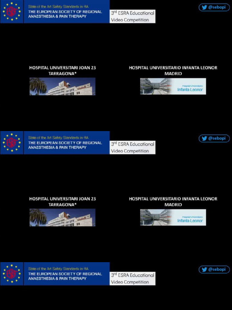 Ultrasound Assisted Lumbar L5 S1 Transforaminal Block Without Audio ...