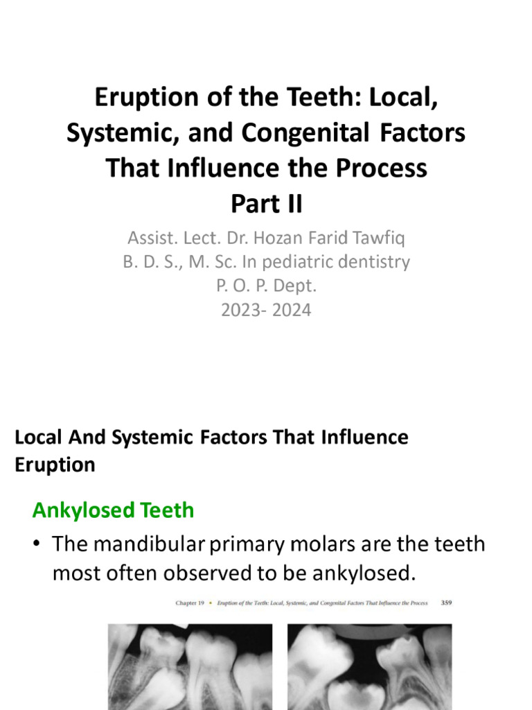 Eruption of The Teeth Part II | PDF | Human Tooth | Dentistry Branches