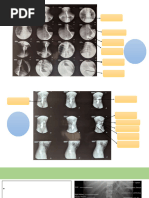 Loopogram Procedure for Urinary Diversion | PDF | Surgery | Surgical ...