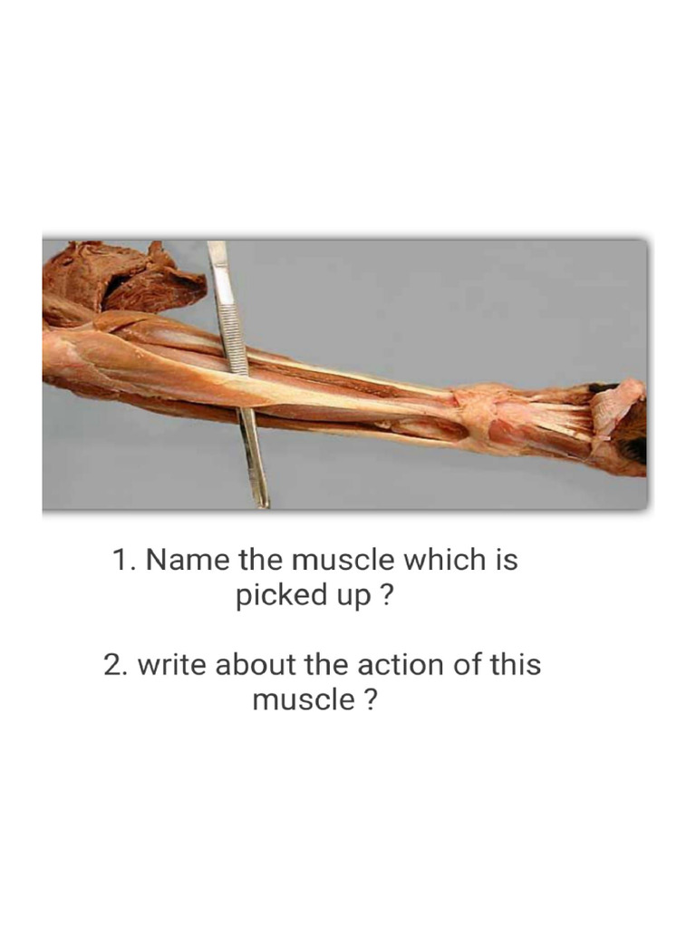 Upper Limb Spotter (Class Prepared) | PDF