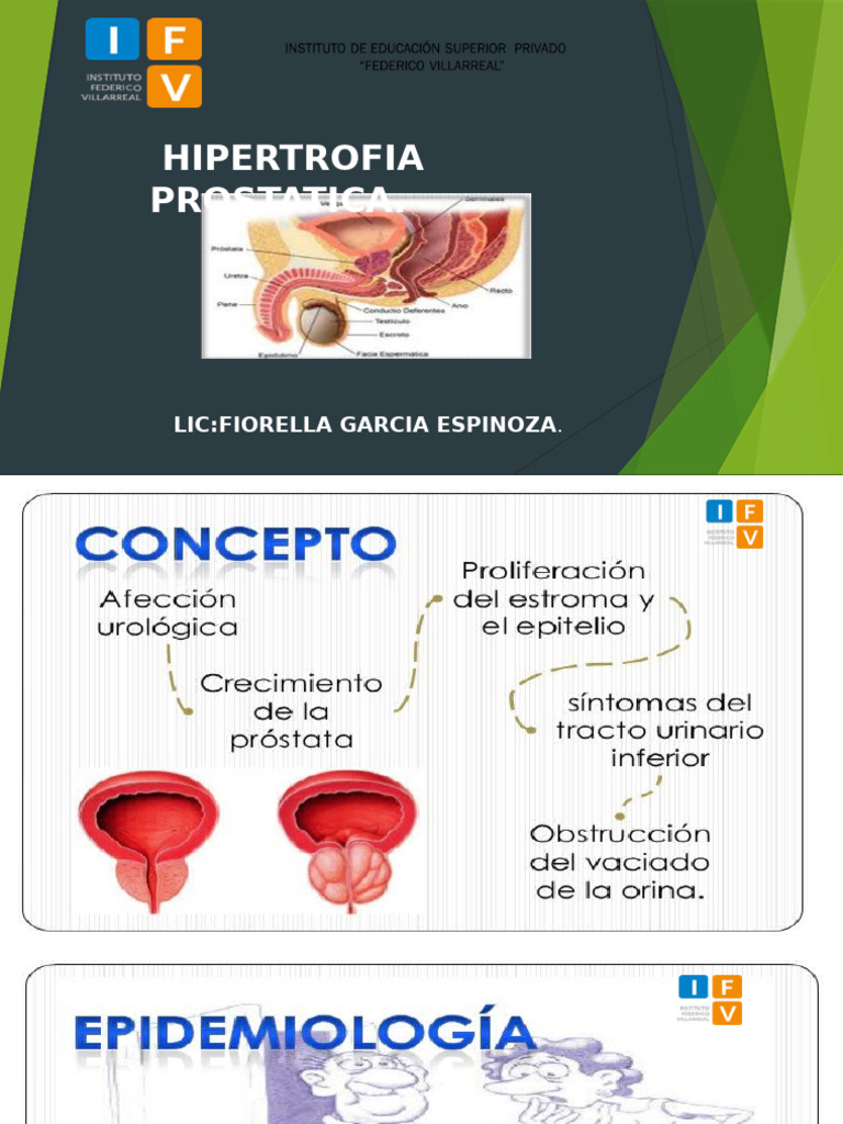 Hipertrofia Prostatica | PDF