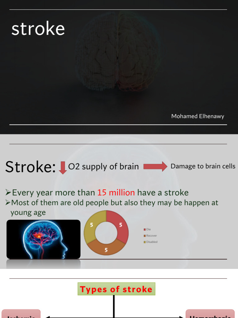 Types and Causes of Stroke | PDF