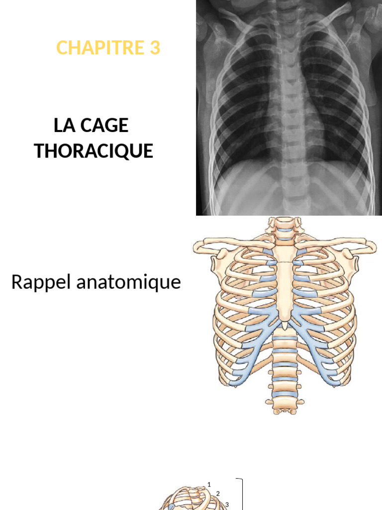 RX Thorax | PDF | Thorax | Appareil locomoteur
