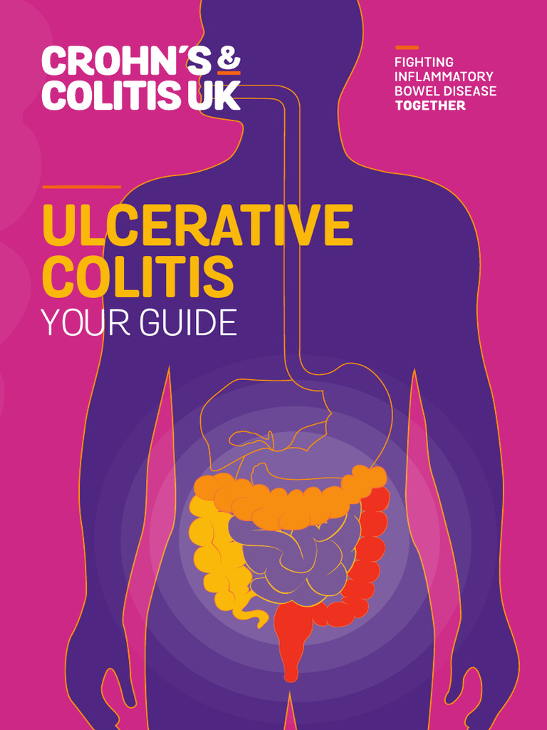 Ulcerative Colitis | PDF | Ulcerative Colitis | Inflammatory Bowel Disease