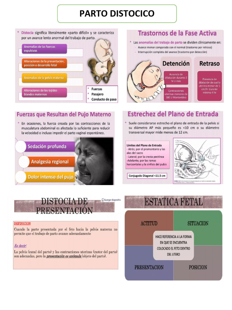 Parto Distocico | PDF