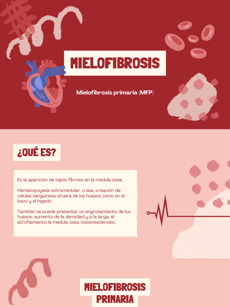 Mielofibrosis | PDF | Hueso | Causas de la muerte